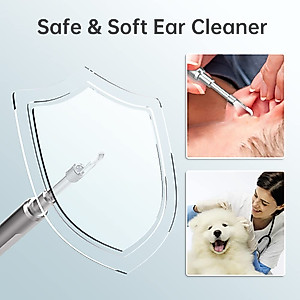 3.5mm Digital Otoscope Camera with Light, Visual Ear Camera and Ear Wax Tweezers with Light, Video Ear Scope with Ear Wax Remover, Ear Endoscope Cleaner, 32GB, 1080P HD, No Phone Needed