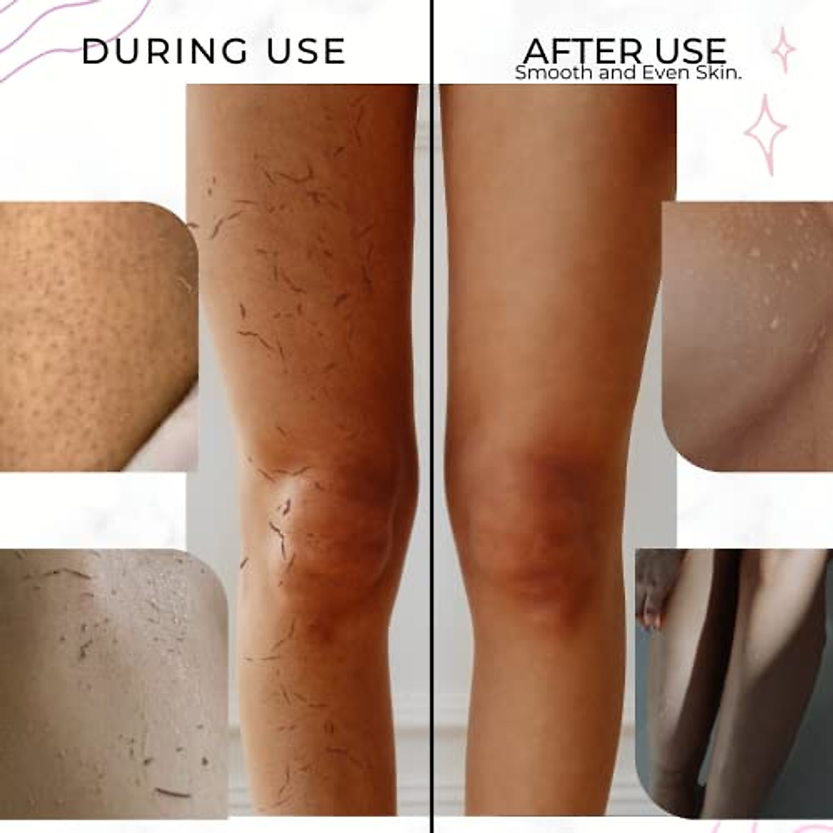 Asymi Deep Exfoliating Glove - Reusable Exfoliating Mitt for Dead Skin Removal (Keratosis Pilaris Strawberry Legs Ecologic body care) Vegan Body Scrub SPA body Treatment (Grey Cloudy), 1.0 Count