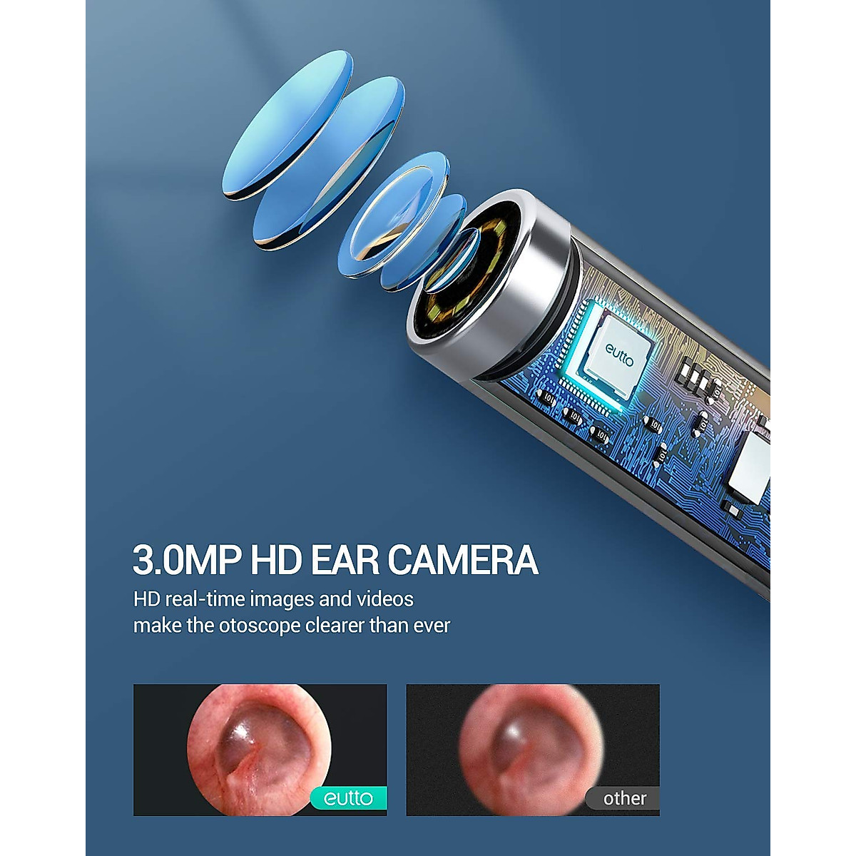 eutto Wireless Otoscope with Gyroscope, 0.15in Probe HD Ear Camera, 6 LED Lights, Ear Inspection Camera, Ear Wax Removal Tools, Compatible with iPhone and Android