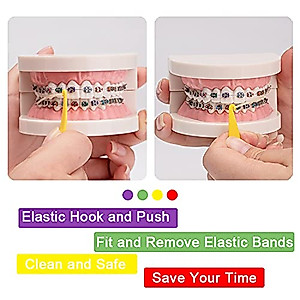 50 Pack Braces Rubber Band Tool Dental Elastic Rubber Bands Placers for Braces Disposable Plastic Orthodontic Elastic Placers (50 Count)