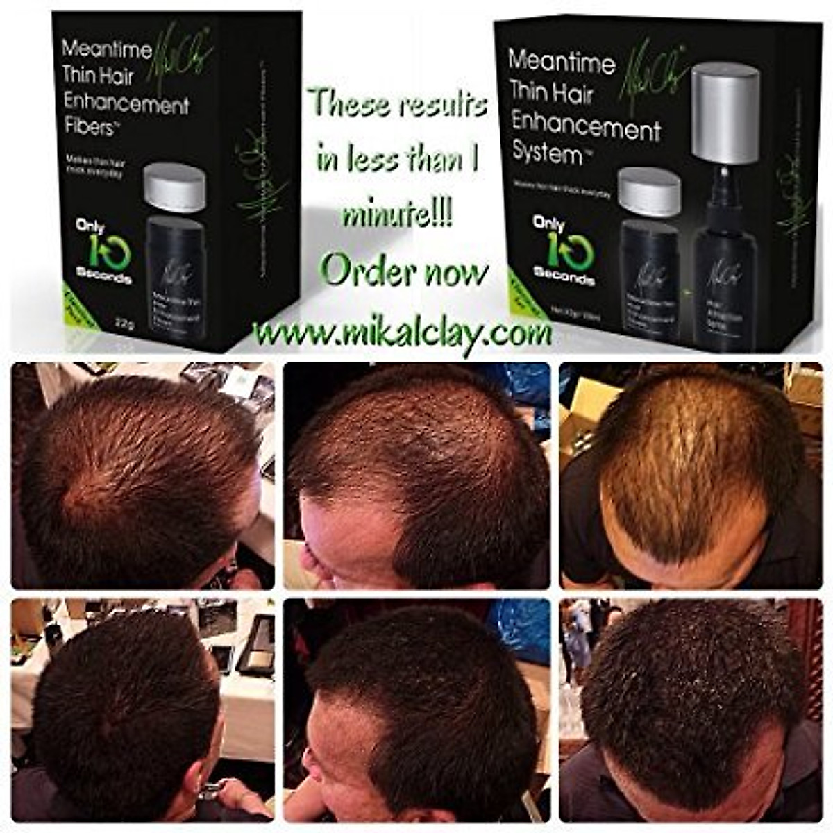 Meantime Thin Hair Enhancement Fibers (Dark Brown): Pliable Hair Enhancement Product for Receding Hairline & Overall Thinning - Thickens & Cover Maximum Areas, Makes Thin Hair Thick. Quick