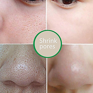 Glycolic Acid 7% Toning Resurfacing Solution