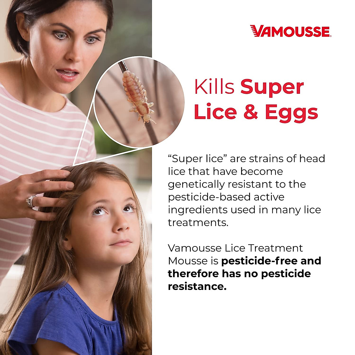 Vamousse Lice Treatment Mousse (6 fl oz), Clinically Proven to Kill Super Lice & Eggs, Easy to Apply & Rinse, Pesticide-Free & Non-Toxic, Includes Reusable Steel Comb