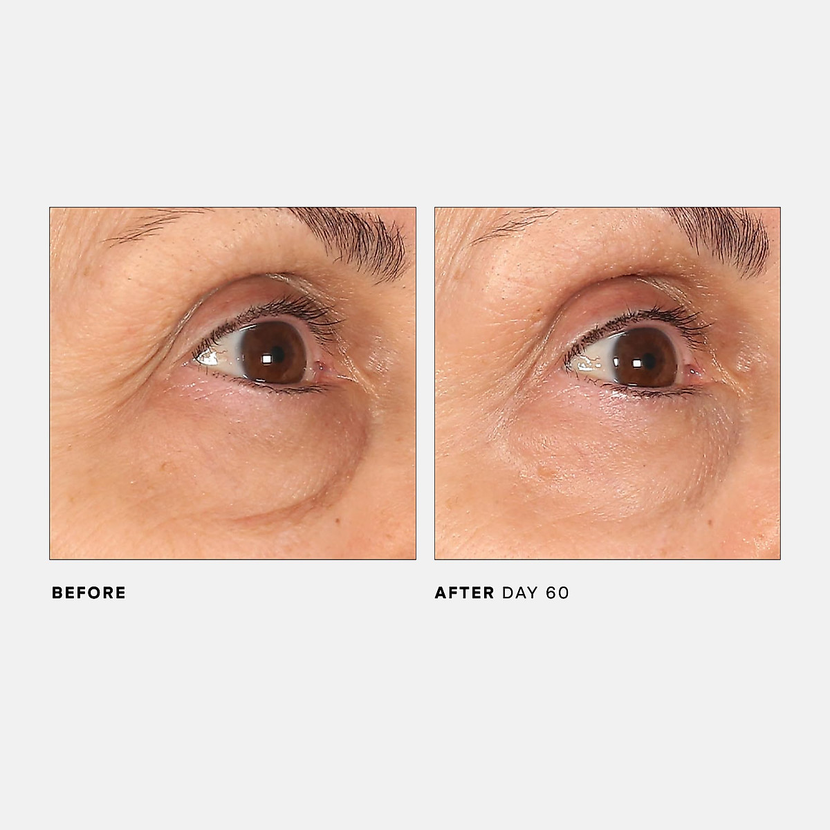 U Beauty The RETURN Eye Concentrate - Anti-Aging Eye Cream with Peptides and Antioxidants for Brighter and Tighter Under Eyes, Reduce Fine Lines, Puffiness & Dark Circles - 0.5 fl oz