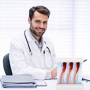 Human Body Skeleton Anatomical Model Low- Density Lipoprotein Blood Vessel Model