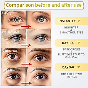 NAZANO Under Eye Patches - 30 Pairs - 24K Gold Eye Mask- Puffy Eyes & Dark Circles Treatments,Reduce Under Eye Bags and Smooth Wrinkles,Eye Skin Care Pads With Collagen