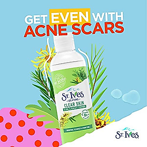 St.Ives Solutions 3-in-1 Face Toner For Combination to Oily and Acne Prone Skin Clear Skin Made with 100 percent Natural Tea Tree Extract, Vitamin B3, Micellar Water Technology, and Witch Hazel 8.5 oz