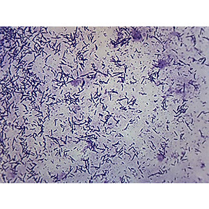EISCO (Pack of 25) Escherichia Coli Smear, Gram Stain, Prepared Microscope Slides - 75 x 25mm - Classroom Pack, 25 Slides in Storage Case - Biology & Microscopy