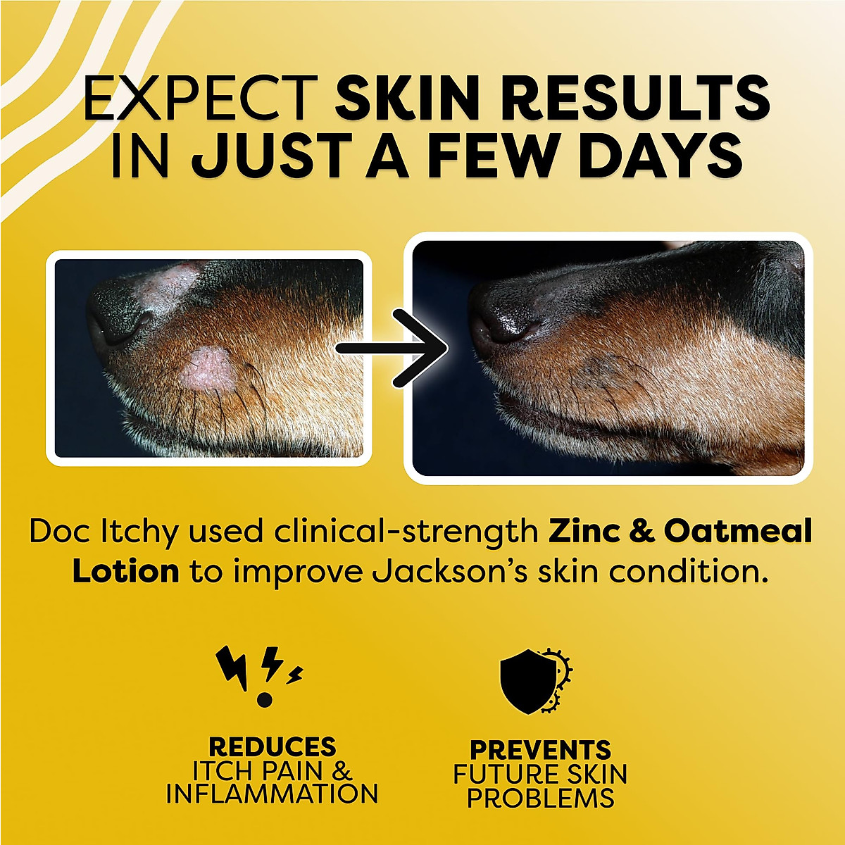 Doc Itchy: Allergy Armor Itch Relief Conditioner & Leave-on-Lotion | Clinical-Strength Zinc & Oatmeal | Banish Rashes, Calm Itch, Rebalance Skin Microbiome | Nurture Skin Health | Made in USA | 12 oz