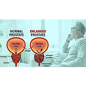 Prostate Gland Health Care Device for Men Prostatitis Pelvic Inflammation