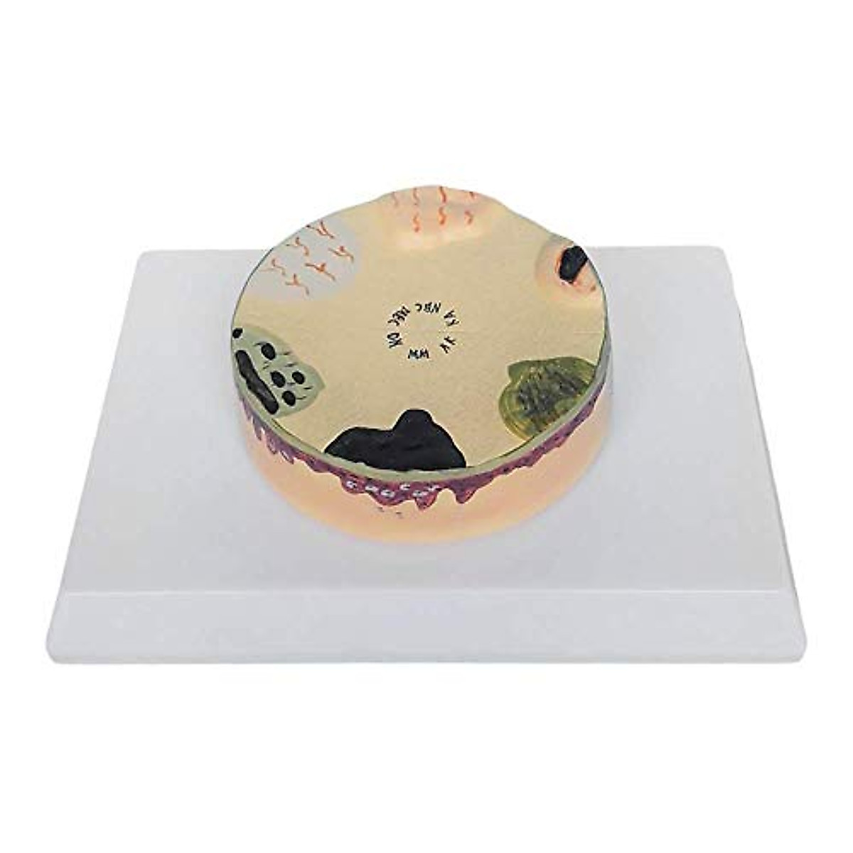 Anatomy Model Human Skin - Skin Enlarged Anatomy Model - Medical Anatomical Skin Structure Model Medical Teaching Model - for Medical Educational Aid