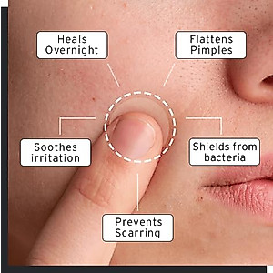 No BS Intensive Overnight Pimple Patches - Fast-Acting Acne Spot Treatment for Clear, Healthy Skin -Hydrocolloid, Salicylic Acid, Calamine (1 BOX of 36ct). Includes Free Skincare Samples