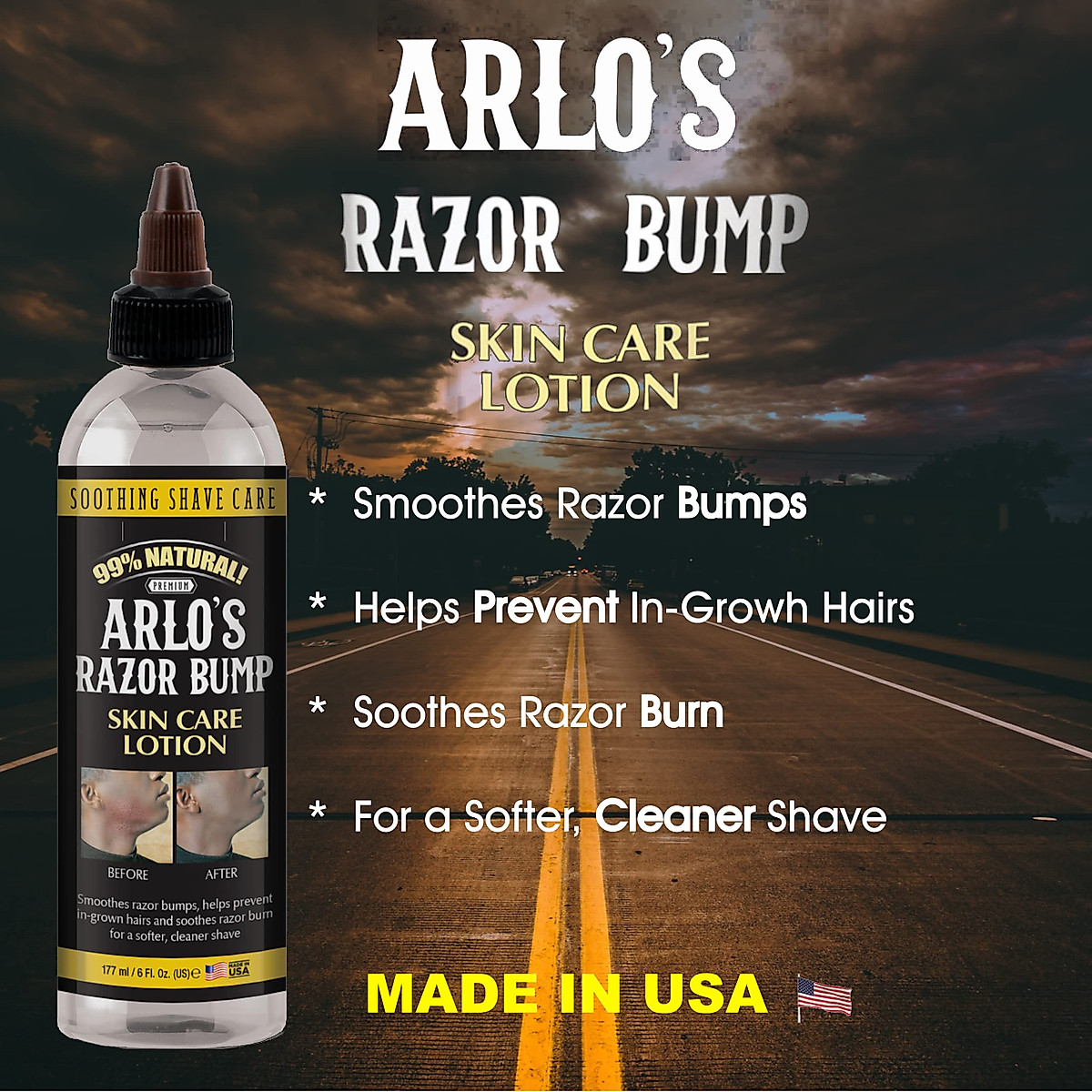 Arlo's Razor Bump Skin Care Lotion 6 oz.