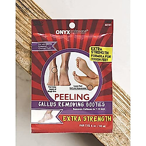 Onyx Professional Foot Peel Mask Callus Remover (2 Pack) Dead Skin Remover, Foot Exfoliator, Cracked Heel Repair - Feet Peeling Mask Pedicure Kit For Smooth Baby Soft Healthy Feet