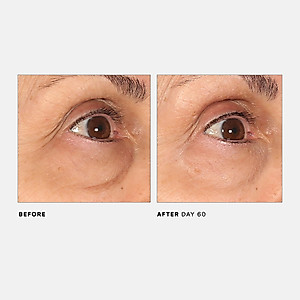 U Beauty The RETURN Eye Concentrate - Anti-Aging Eye Cream with Peptides and Antioxidants for Brighter and Tighter Under Eyes, Reduce Fine Lines, Puffiness & Dark Circles - 0.5 fl oz