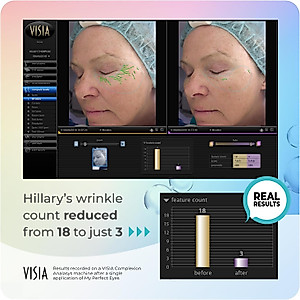 My Perfect Eyes 10ml, 100 Applications, Penny Lane, Instant Results, Clinically Proven, Anti-Ageing Serum UK Original Formula, Science-Backed Anti-Wrinkle Serum. As Seen on TV.