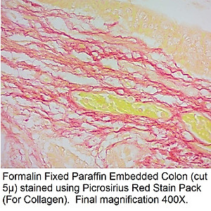 Picrosirius Red Solution, 500ml