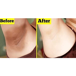 20 Pcs Crema Aclaradora Para Piel Manchas En Cara Axilas Cuello Entrepierna - (1.77FL.Oz x 20 Pcs)