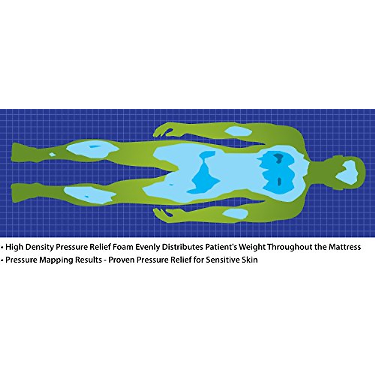 Kolbs NSR Long Term Care Pressure Redistribution Foam Mattress