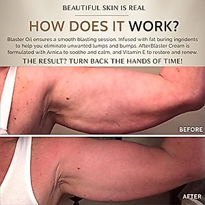The Blaster Oil and After Blaster Cream by Ashley Black. Use with FasciaBlasting for Maximum Results. Blaster Fat Burning Oil and Soothing Arnica and Skin Tighteners for Post FasciaBlast