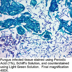 Schiff's Solution, 1 Gallon