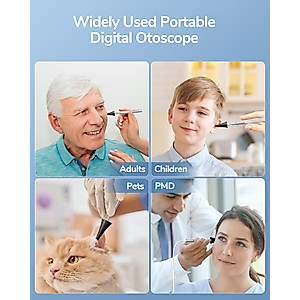 Teslong Otoscope, Video Otoscope with Light, Digital Otoscope with Ear Wax Removal Tools, Ear Camera for Android Phone, USB, with Ear Picks