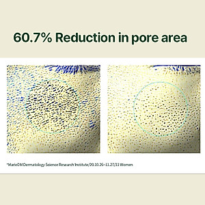 Pyunkang Yul Calming Line Gift Box Set-Korean Facial Skin Care Essential for Daily Moisturizing with Toner, Serum, Cream, Safe on Acne Prone & Sensitive Skin, Vegan & Cruelty Free