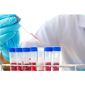 Ackers Conical Centrifuge Tubes 15mL, 100 Pcs Sterile Plastic Test Tubes with Screw Caps, Polypropylene Container with Graduated and Write-on Spot, Non-Pyrogenic, DN/RNase Free