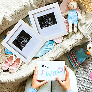 Green Pollywog | Sonogram Picture Frame | White Frame | Ultrasound Frame | Pregnancy Gifts for First Time Moms | Baby Ultrasound Picture Frame | Gifts for Parents/Grandparents | Nursery Decor