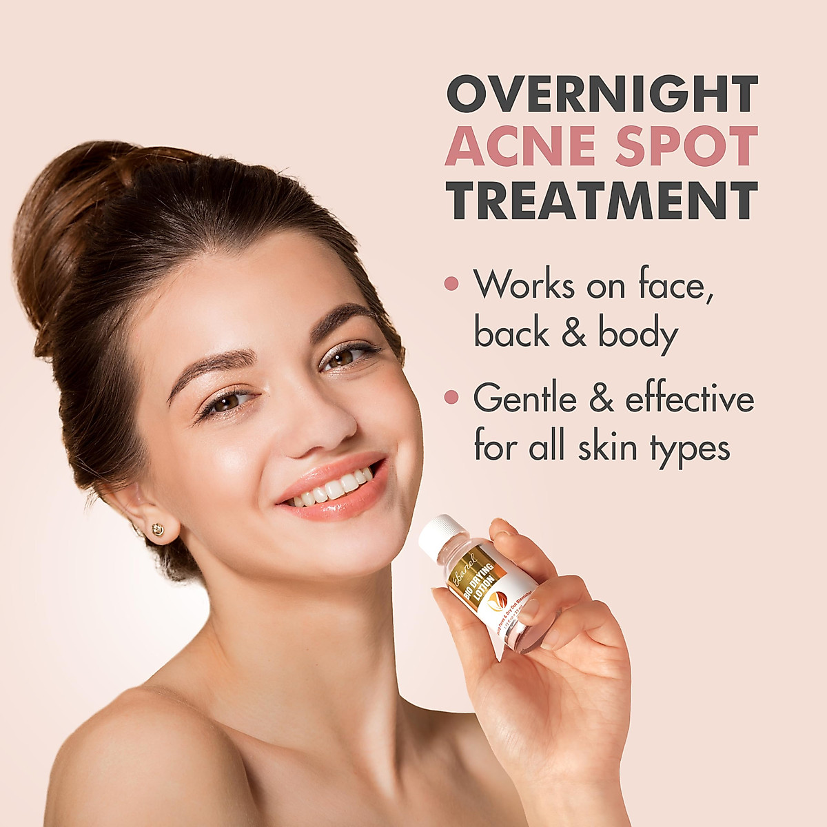 Ebanel Acne Drying Lotion, Overnight Salicylic Acid and Sulfur Cystic Acne Spot Treatment for Face and Body, Pimple Cream Spot Treatment, Dries Out Pimples, Cysts, Blemishes, Zits, and Clogged Pores