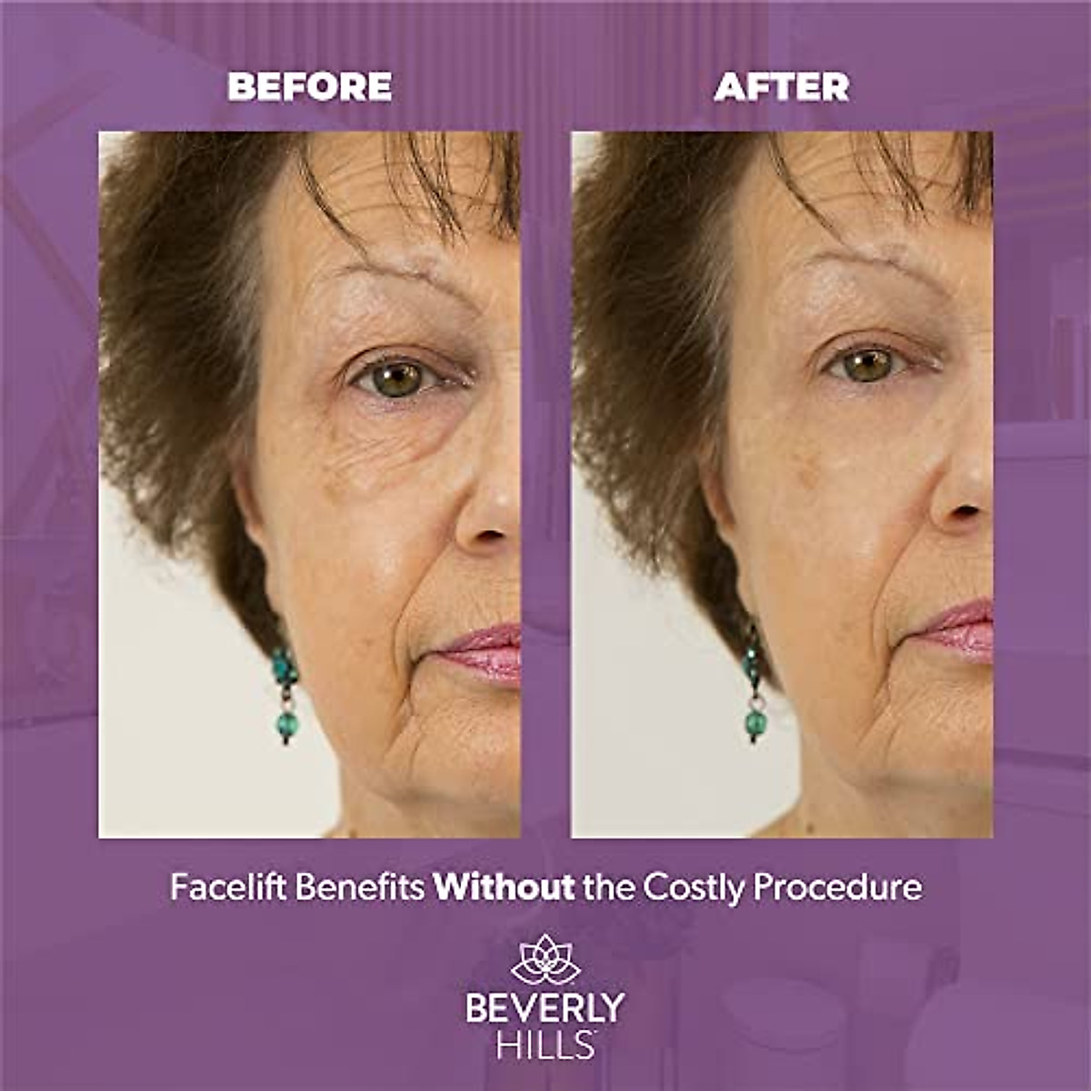 Beverly Hills Instant Facelift Anti Aging Eye Serum Treatment for Dark Circles, Puffy Eyes, Wrinkles, Under Eye Bags, Fine Lines, and Crows Feet that Works Within 90 Seconds | 30mL (120 Days Supply)