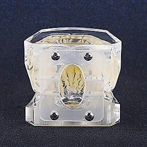 Teeth Educational Model Dental Treatment Malocclusion Study Demonstration Teeth Model with Wire Chain Orange