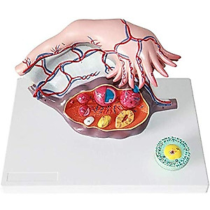 DEAVER Medical Models, Uterine Anatomy Model Ovarian Enlargement Model Skin and Genitourinary System Anatomical Medical Training Aid