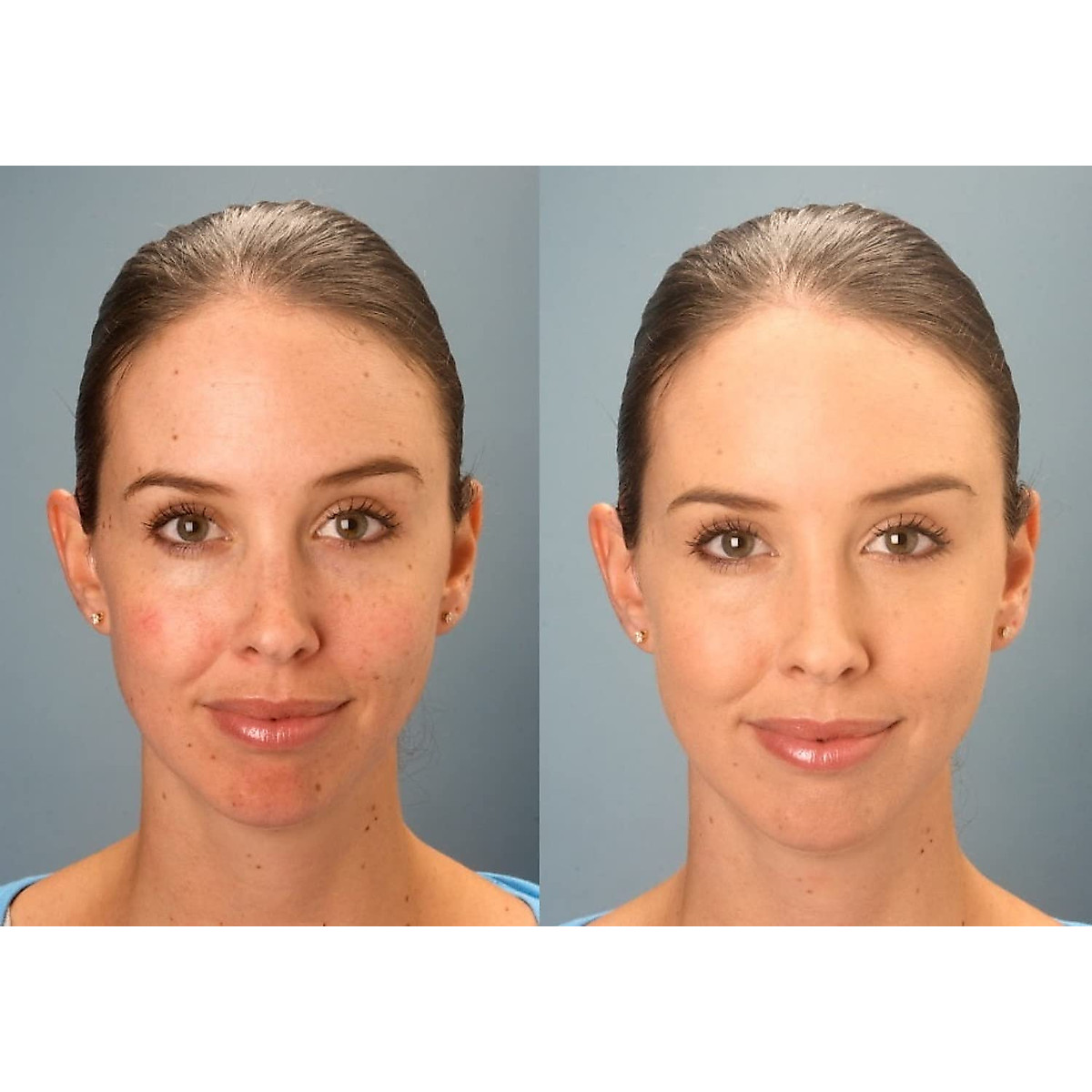 Dr. Denese Advanced SPF 30 Defense Day Cream | BB CREAM | UNIVERSAL SHADE | 2oz |