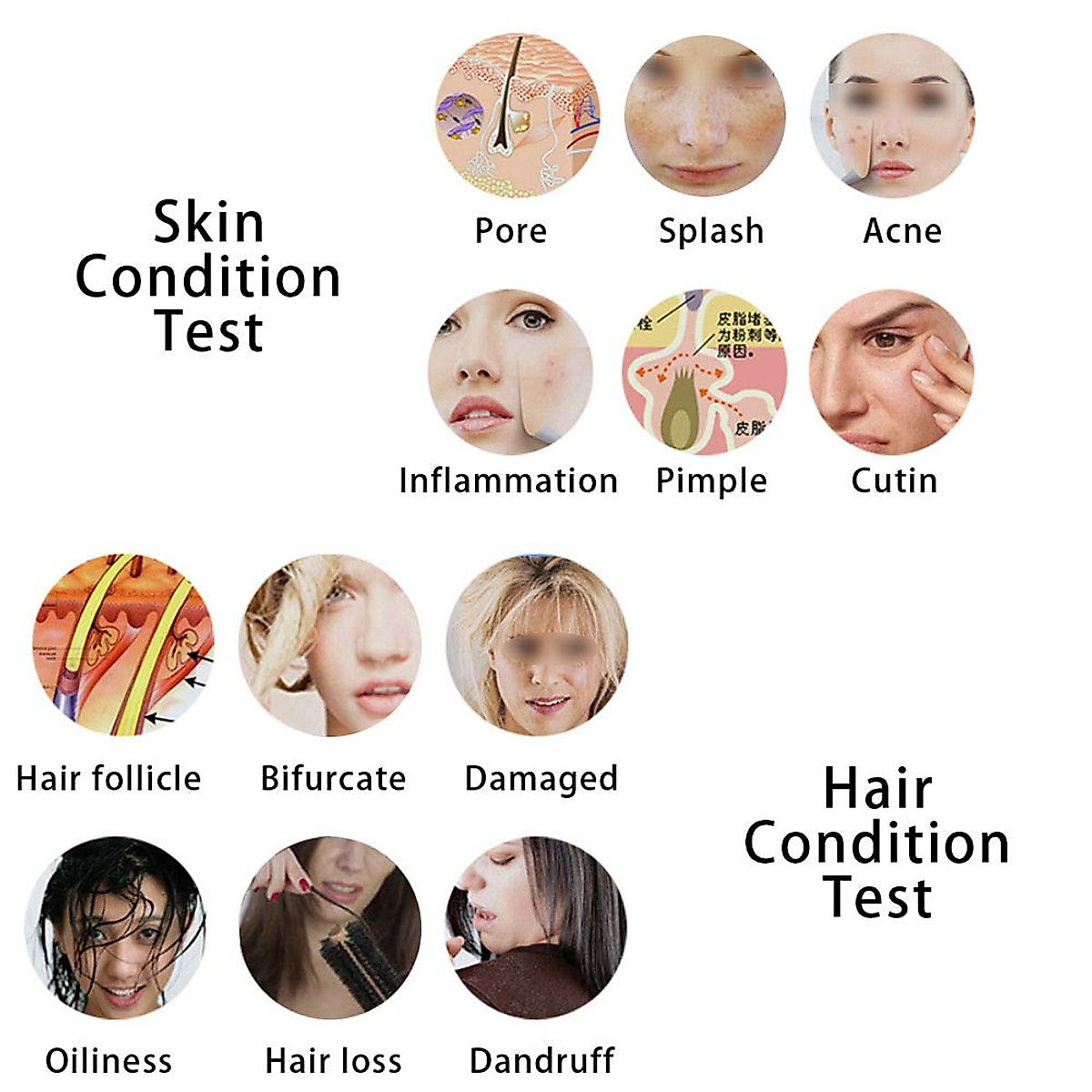 FOKH Skin Hair Analyser,5 in 50X/200xLens LCD Digital Microscope Rechargeable Portable Scalp Detector Scanner Professional Scalp Hair Follicle Oil Moisture Magnifying Detector Skin Pigment Tester,US