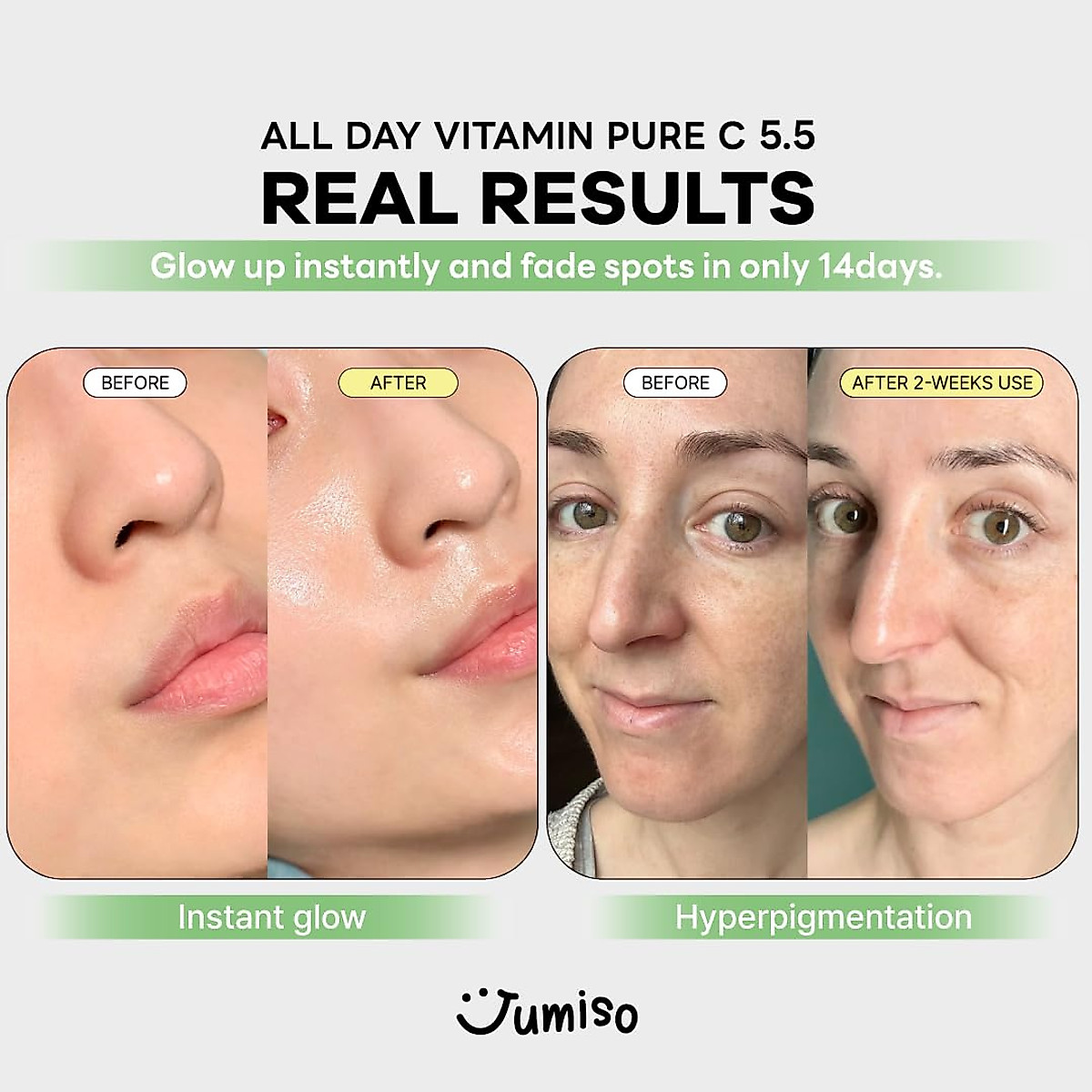 All Day Pure C 5.5 Glow Serum 30ml | Aronia Fruit Extract | Pure Vitamin C (L-Ascorbic Acid) with Alpha-Arbutin&Ascorbyl Glucoside | fragrance-free, parabens-free | 1.01 fl oz, 30 ml