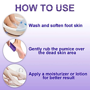 BPrettier Foot Pumice Stone Pumice Stone for Feet Foot Scrubber Sponge Callus Remover Dead Skin,Pedicure Supplies Nail Salon Home Use 40 PCS