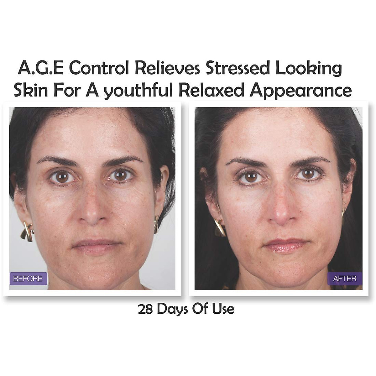 AGE Control Dual Treatment Anti Glycation Serum: Look 8-10 Years Younger In 60 Days. Reduce Discoloration & Dark Spots, Lifting, Firming, Brightening, Hydrating, Anti-Wrinkle, Non Greasy