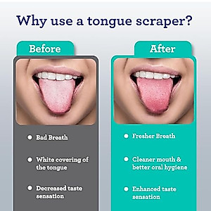 GuruNanda Tongue Scraper for Adults (2 Pack) with Travel Case, 420 Medical-Grade 100% Stainless Steel Tongue Cleaner, Aids in Fresh Breath & Oral Care