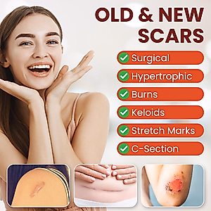 e70 Intensive Healing Scar Cream - Fast Repair Surgical Scars, C-Section, Stretch Marks, Keloids, Burns, Old & New Scars. Vitamins Full - All Skin Types - Reduce Acne Spots Appearance - 2.0 Fl Oz