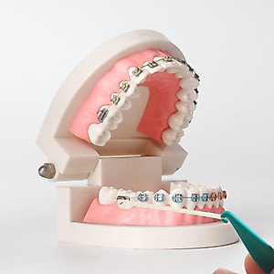 Orthodontic Elastic Rubber Bands, 500 Pack Medium Force Small Rubberbands Dreadlocks Hair Braids Fix Tooth Gap, Heavy 3.5 Ounce, 5 Pack Free Elastic Placer for Braces