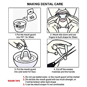 40 PCS Silicone Mouth Guard for Teeth Clenching Grinding Moldable Dental Night Guards Bite Sleep Aid by Giveme5 (40 PCS)