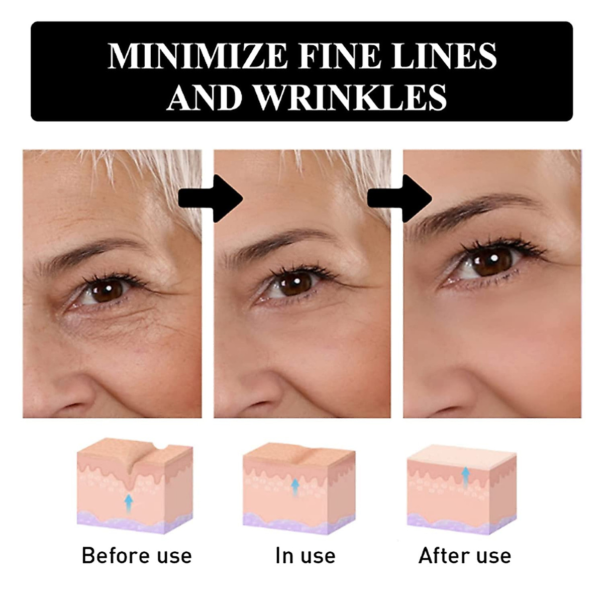 Jaysuing Collagen Boost Anti-Aging Serum Firming Eye Cream, Collagen Boost Anti-Aging Serum, Verfons Firming Eye Cream for Bags, Fades Fine Lines and Wrinkles (3PCS)