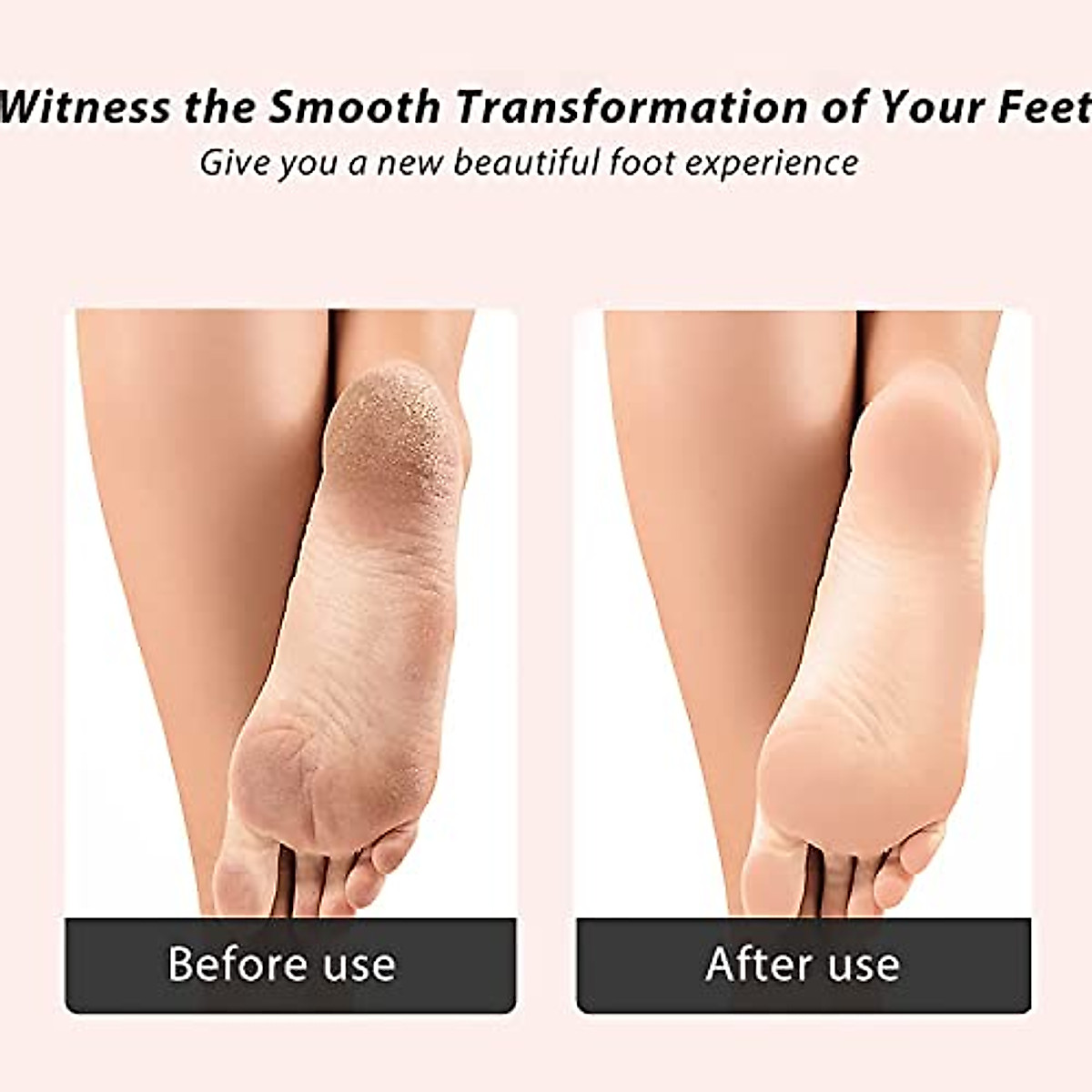 ICANdOIT-4 in 1 Foot File Callus Remover with Long Handle Classic Dry Brushing Body Brush Back Scrubber,Shower Brush for exfoliator Skin and Remove Dead Skin Cells
