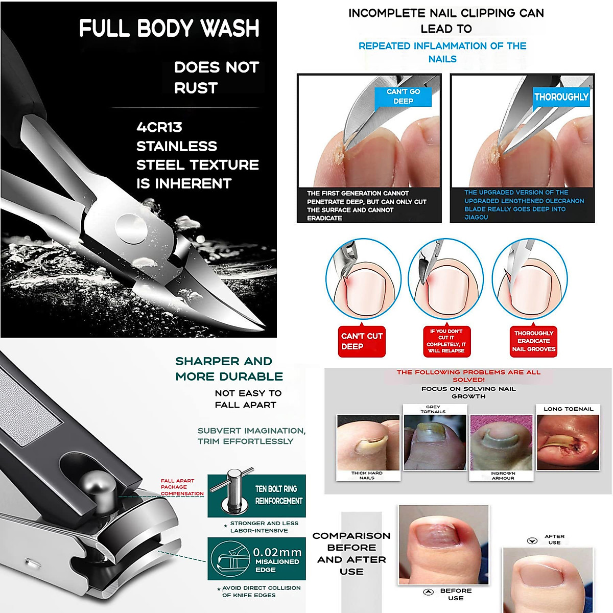 Nail Clippers Set 4Pcs Ingrown Toenail Nail File, Nail Cutter Surgical Stainless Steel Treatment Thick Nail Clipper, Fingernail Clipper for Men Seniors Skin Remover Metal Tin Box Suitable for Gifts