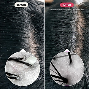 Ethique Heali Kiwi - Calming Solid Shampoo Bar for Dry, Itchy, Flaky, and Oily Scalps and Hair - Vegan, Eco-Friendly, Plastic-Free, Cruelty-Free, 3.88 oz (Pack of 1)