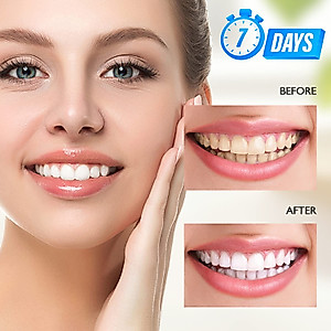 MitButy Teeth Whitening Strips with Natural Coconut Oil, 42 Non-Slip White Strips - Professional Safe Effects Tooth Whitener Solution at Home, 21 Treatments