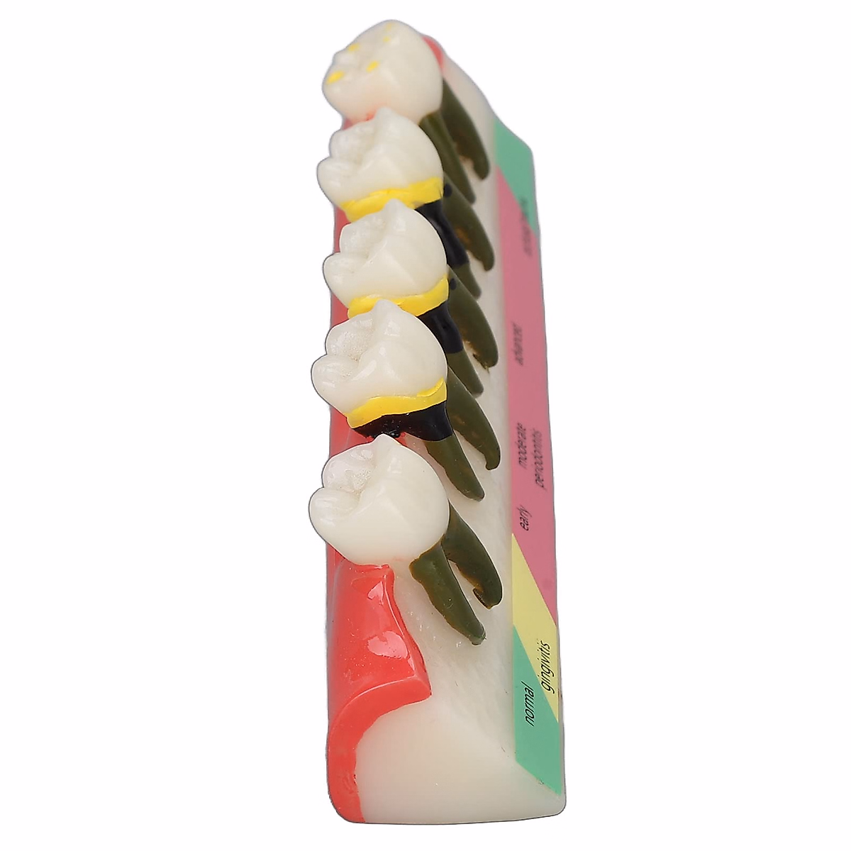 Natudeco Tooth Model Oral Care Model Denture Kit Strong Durable And Convenient. Teachers Use Order Remarks Product Box Plus Buffer Cotton Delivery
