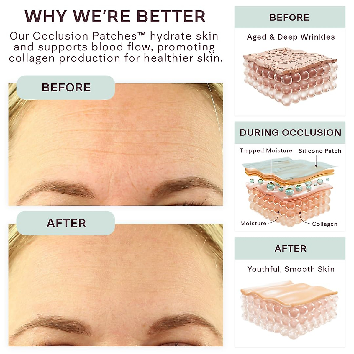 Dermaclara Forehead Patch - Forehead Wrinkle Patches for Face Overnight, Silicone Patches, Reusable Treatment for Wrinkles, Repair & Restore, Up to 30 Uses - 1 Patch