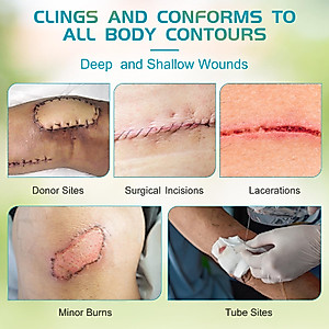 OPTITEKNIK Xeroform Petrolatum Dressing 4"x4" Pack of 25, Non-Adherent Occlusive Fine Mesh Gauze Pad, Gentle Patch for Burns, Laceration, Surgical Incisions & Skin Grafts